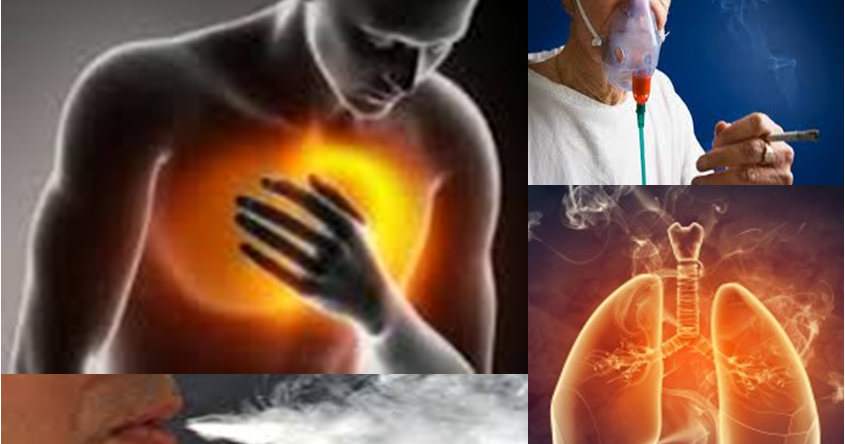 MEDICINA: Epoc exacerbado