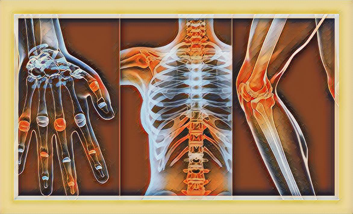 Apa saja gejala radang rematik? - DWI PURWANTO