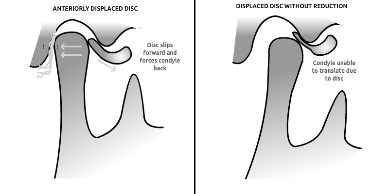 My TMJ Story: Meeting Dr. Piper!