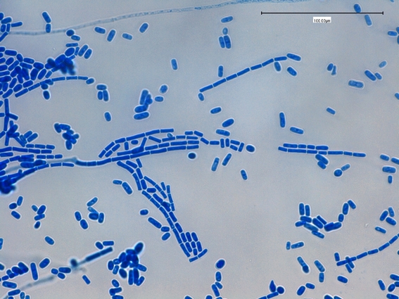 Fun With Microbiology (What's Buggin' You?): Geotrichum candidum
