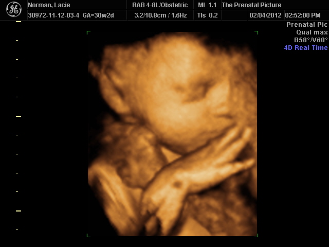 The Norman Family Blog....: 4D Ultrasound (30 Weeks & 2 Day)