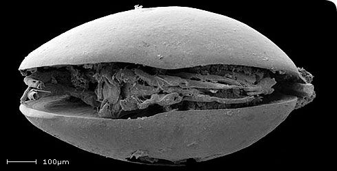 Real Monstrosities: Ostracod