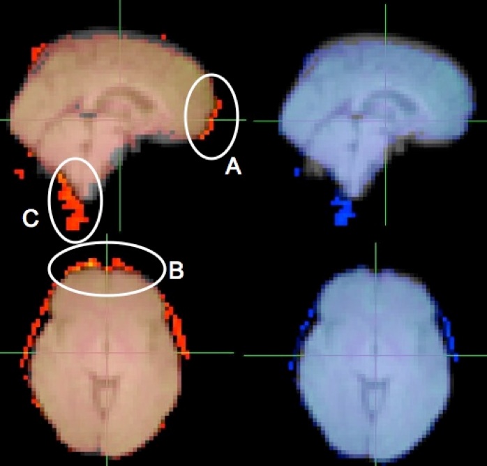 CUBRIC MRI: EPI Unwarping with Fieldmaps