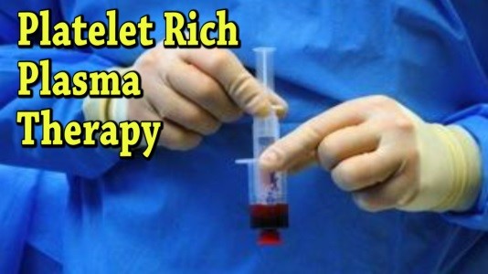 PLATELET RICH PLASMA (PRP): Pletelet Rich Plasma (PRP)