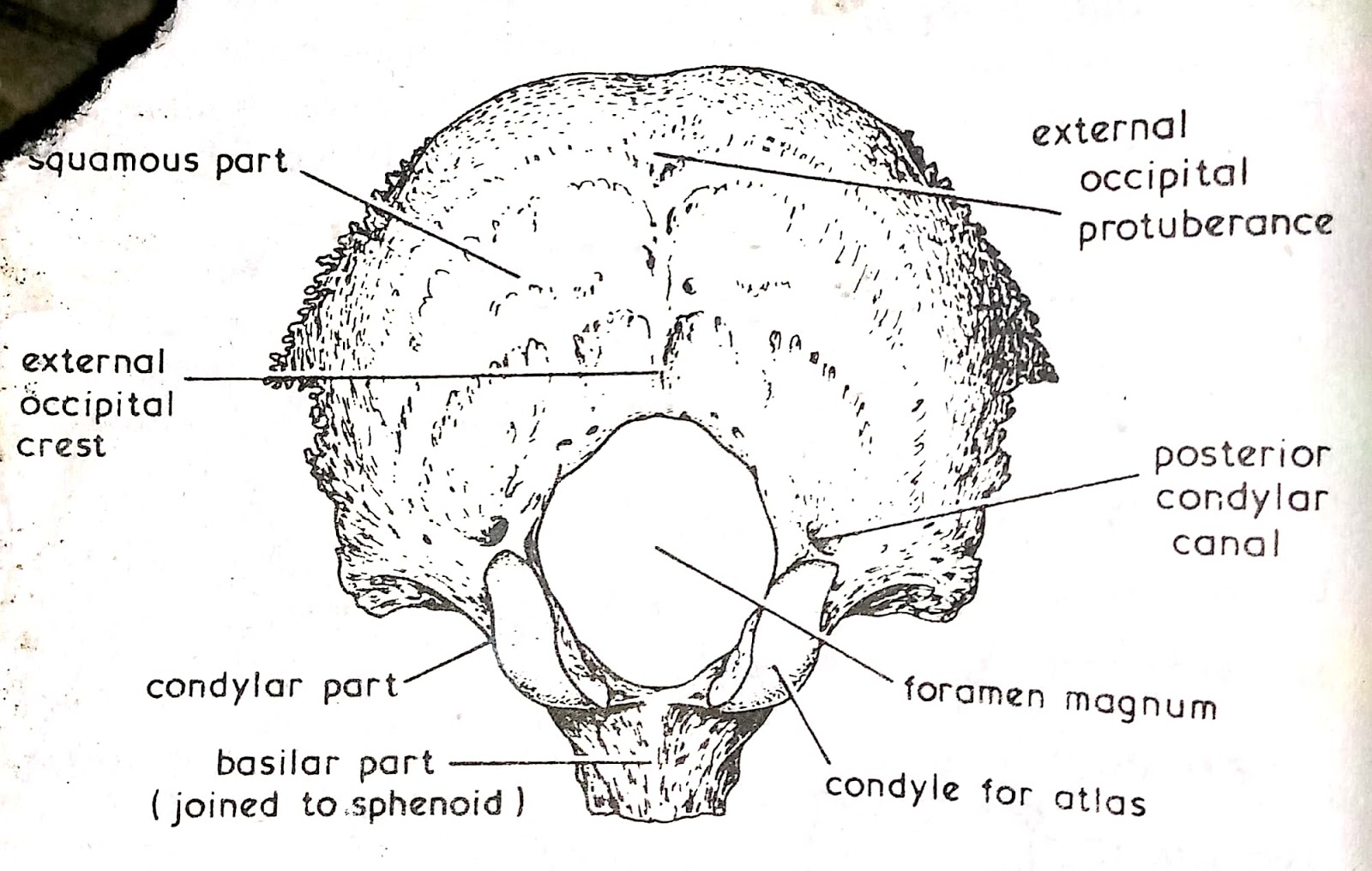 Clinical Notes: The Occipital bone viewed from below