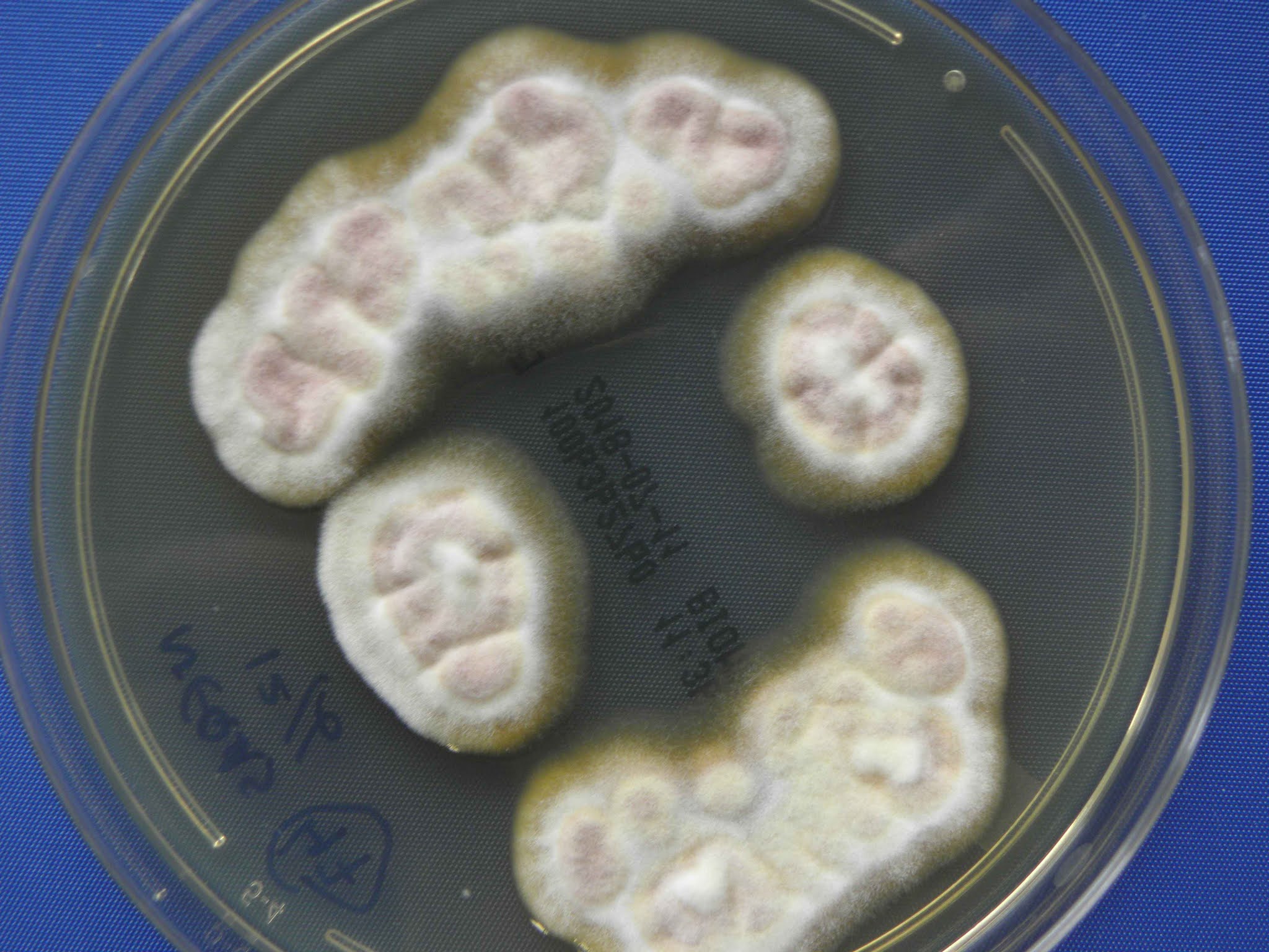 ATLAS MICOLOGIA: TRICHOPHYTON SOUDANENSE (II)