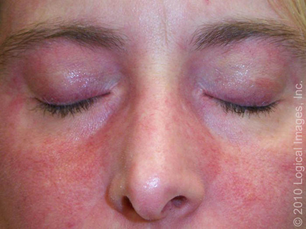 EL RINCÓN DE LA MEDICINA INTERNA: 17 nov 2019