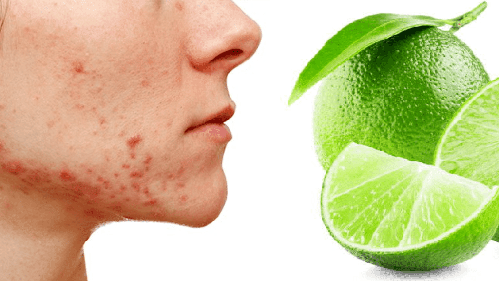 Beneficios del limón