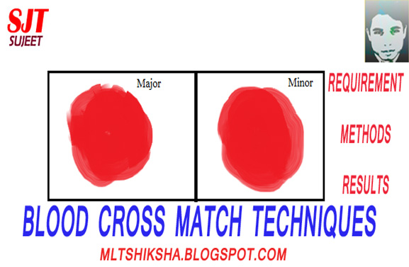 Mltshiksha blogspot Blood Cross Match Techniques mltshiksha-blogspot-blood-cross-match-techniques
