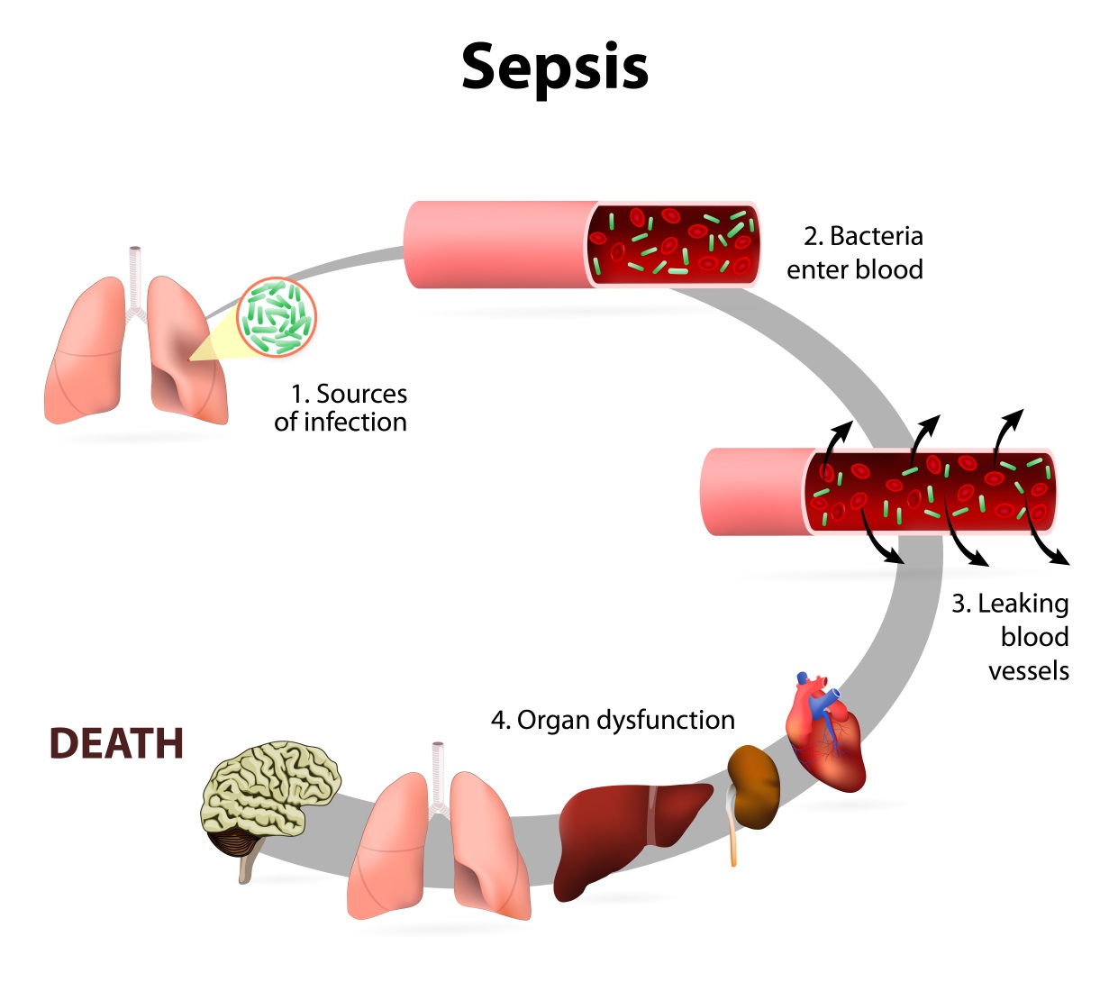 Penalaksanaan Syok Sepsis