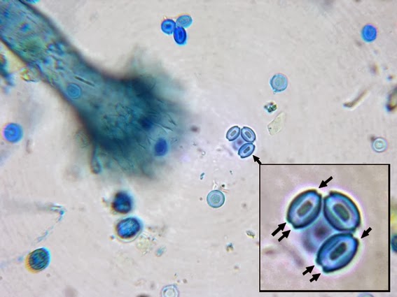 Aspergillus glaucus - Alchetron, The Free Social Encyclopedia