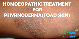 PHRYNODERMA ( TOAD SKIN) & HOMOEOPATHIC TREATMENT