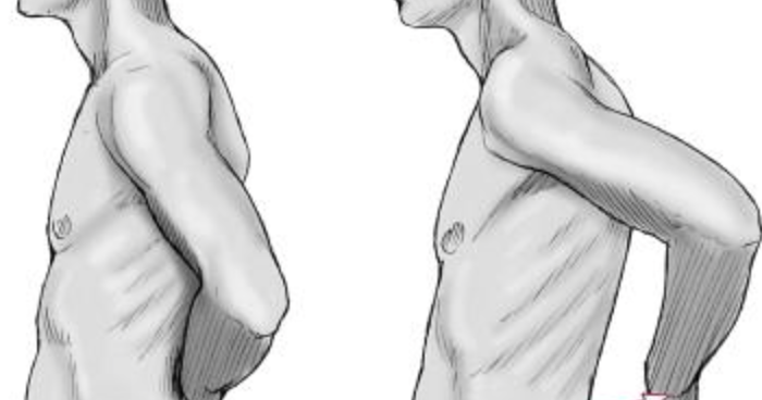 Fisio-Notizie: Lift-off Test