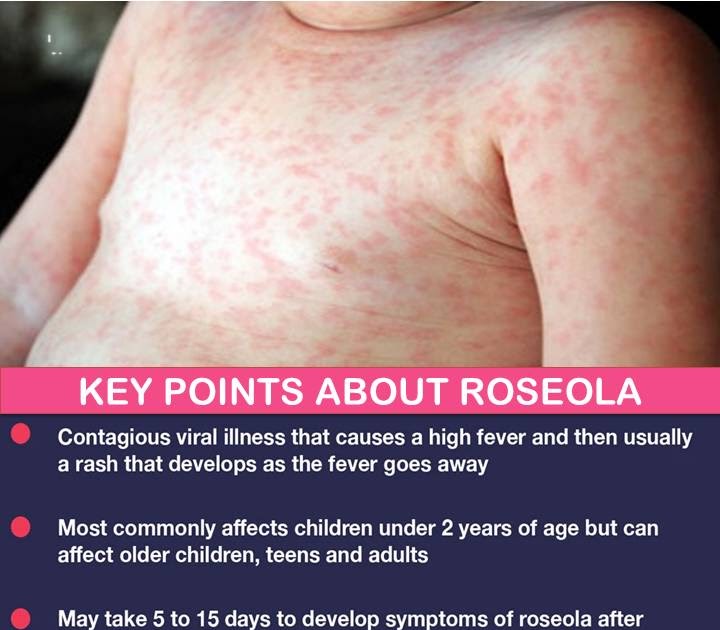 PEDIAMED: ΑΙΦΝΙΔΙΟ ΕΞΑΝΘΗΜΑ-( Βρεφική ροδάνθη ή έκτη νόσος ή Roseola ...