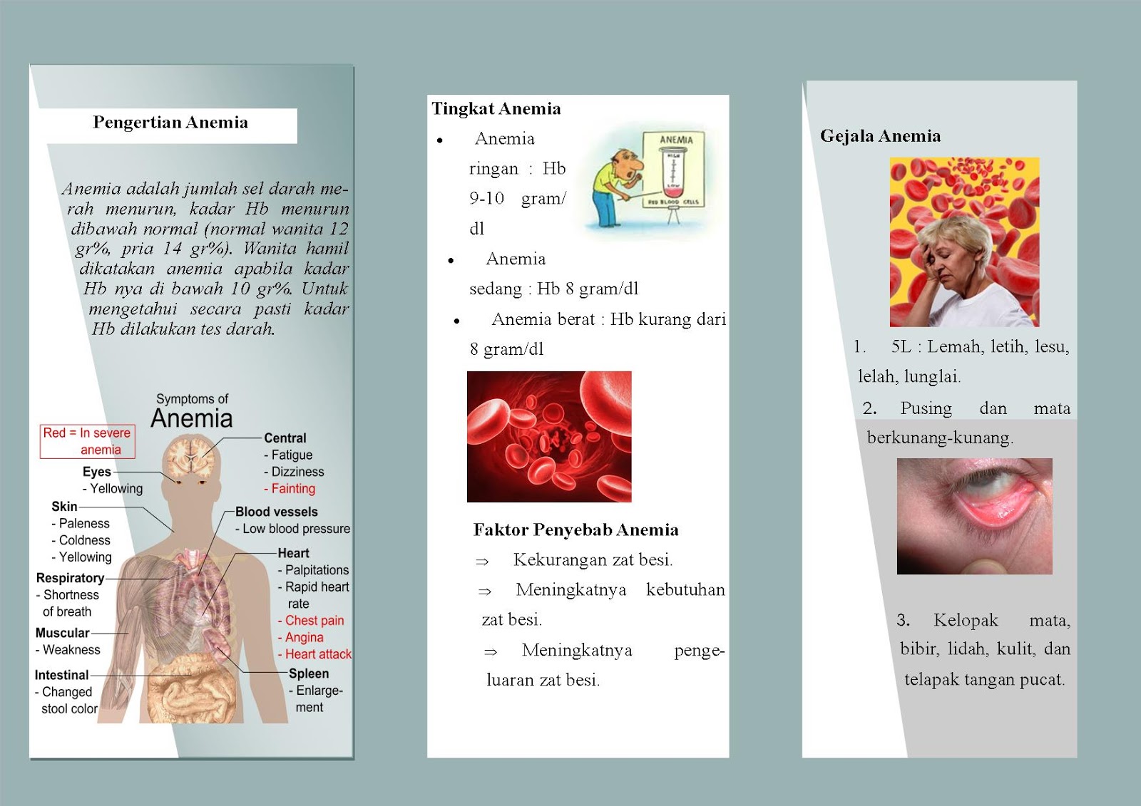 KEPERAWATAN: Kenali Tanda Gejala Anemia KEPERAWATAN: Kenali Tanda Gejala Anemia