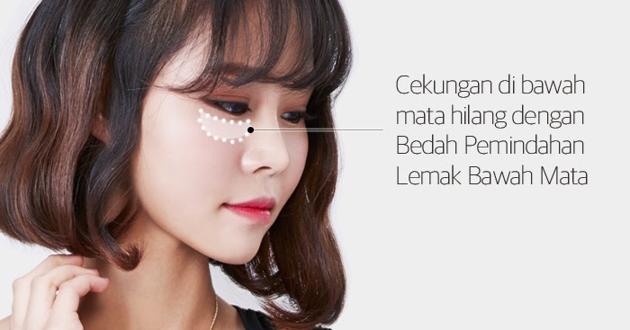 Penguatan membran bawah mata