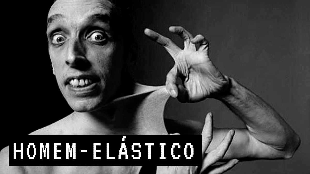 A MISTERIOSA SÍNDROME DO HOMEM-ELÁSTICO (SED)