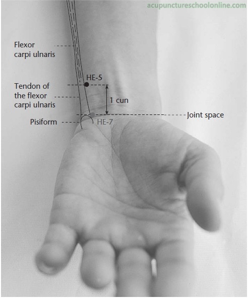 Jarum Sakti: Meridian Sao Yin Tangan/ Jantung
