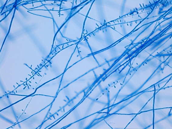 Fun With Microbiology (What's Buggin' You?): Trichophyton tonsurans