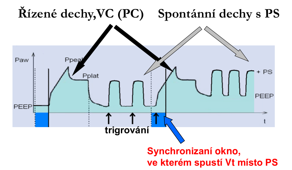 ParaKocour: Ventilační režimy #4 - SIMV - aneb dýchej jak umíš, já to ...