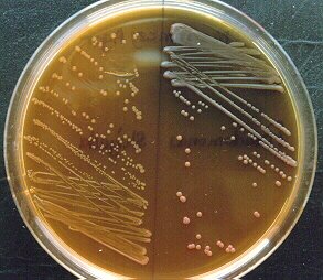 BACTERIAS LACTICAS EN LECHE DE CERDA: METODOLOGIA