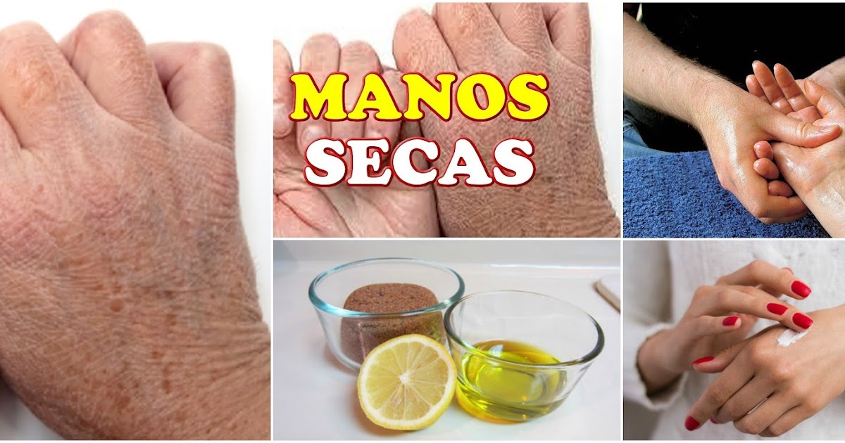 El mejor remedio casero para hidratar las manos resecas y cuarteadas ...