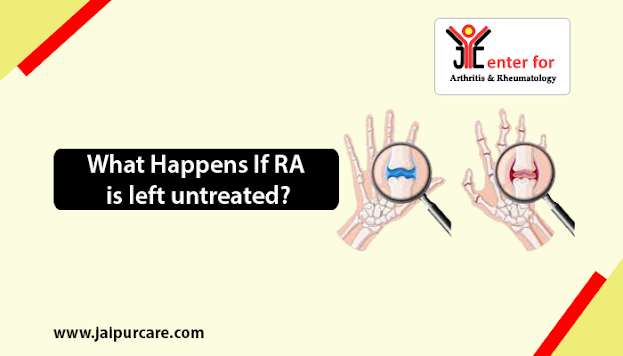 What happens if RA left untreated?
