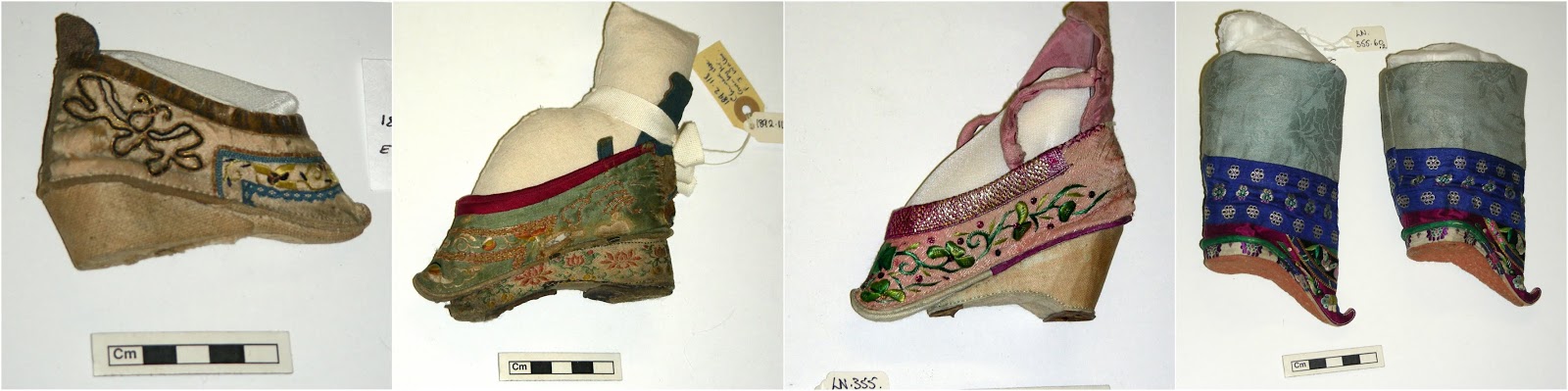 Chinese Foot-Binding