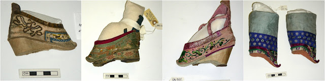 Chinese Foot-Binding