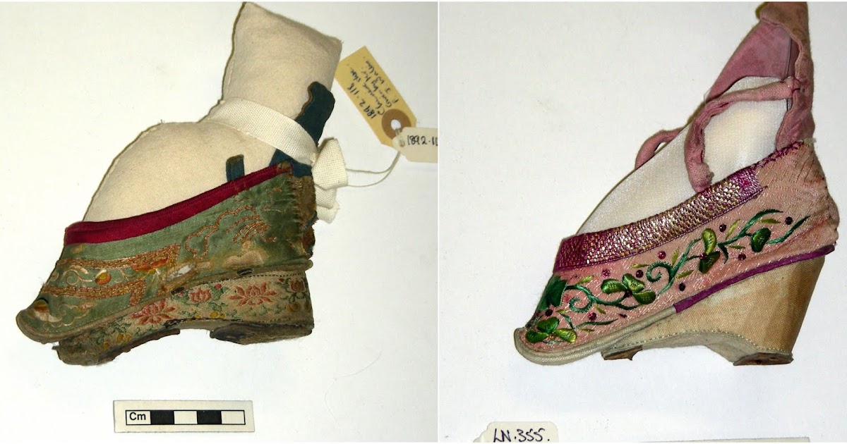 Chinese Foot-Binding