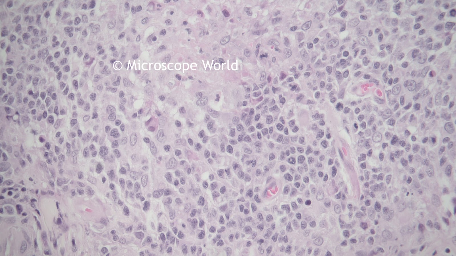 Microscope World Blog: Tissue captured with HD Camera under Microscope