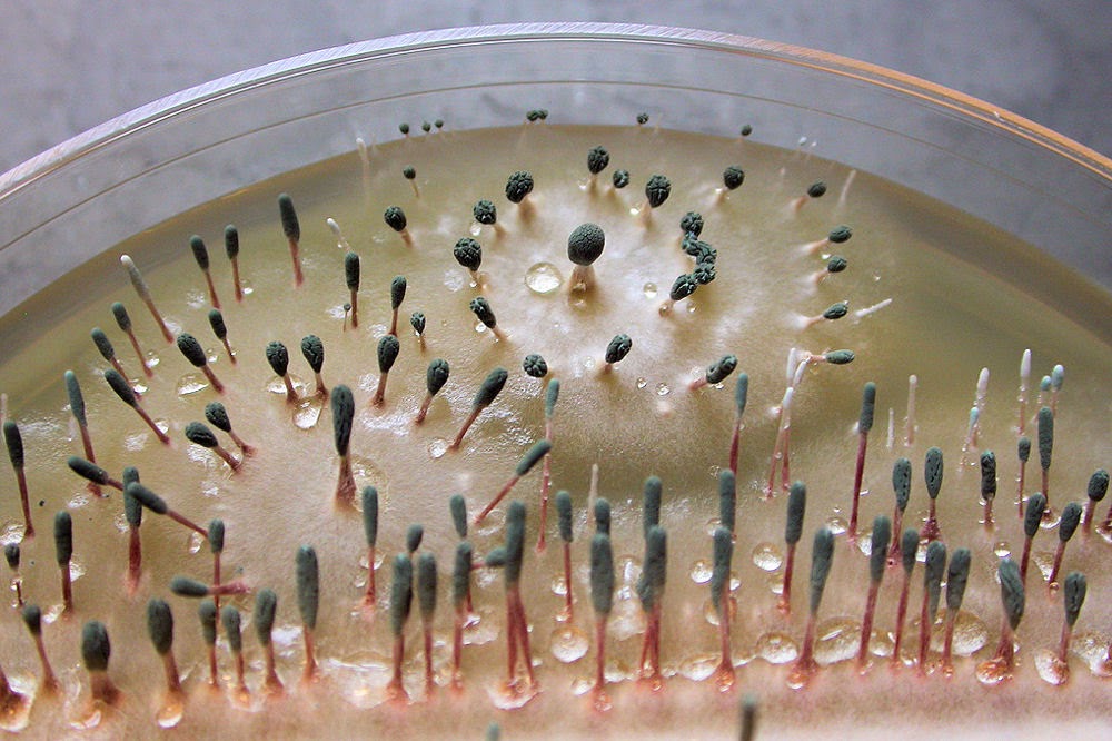 Medical Laboratory and Biomedical Science: Penicillium claviforme on a ...
