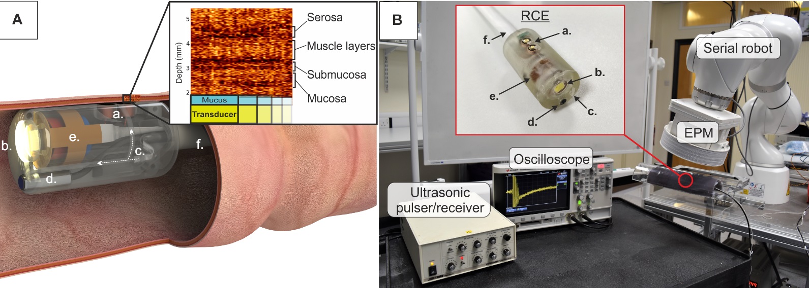 Intelligent US capsule robots on the horizon