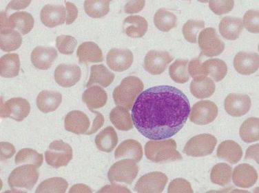 Hematologia Clínica : Atlas de Hematologia