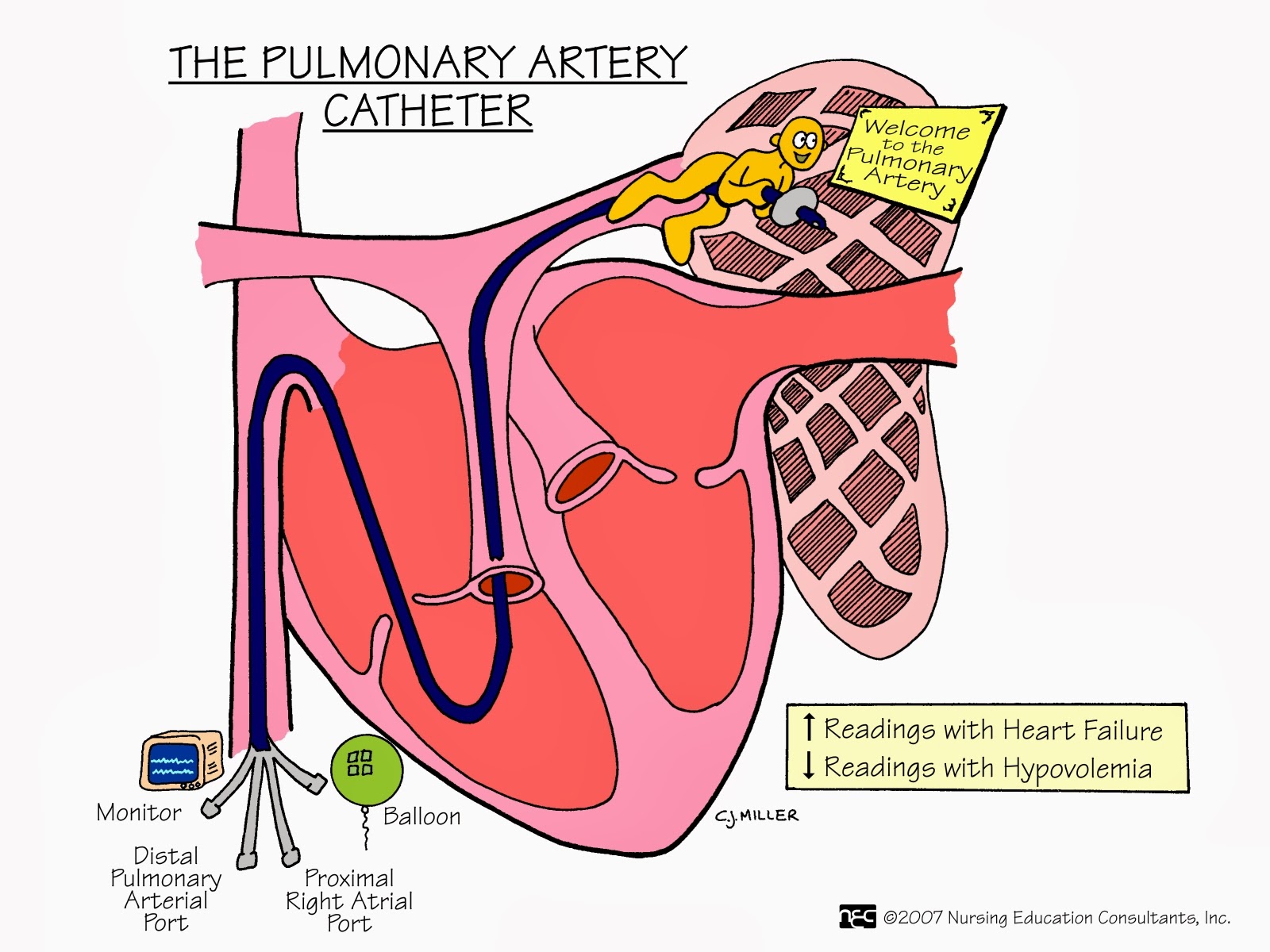Nurses Notes: MS Nursing MNEMONICS 2