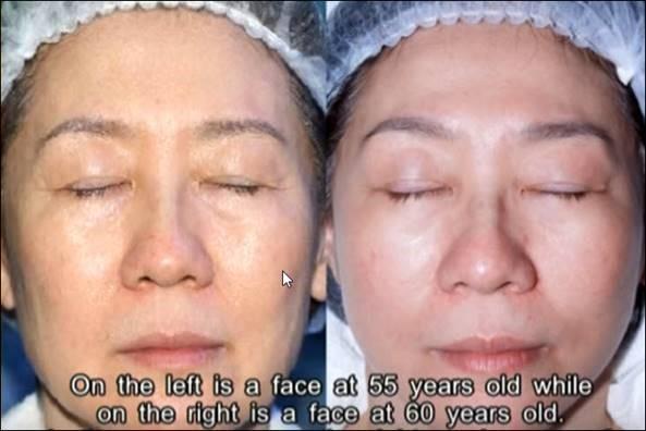 Miracle Capsule proven scientifically and medically to transform any ...