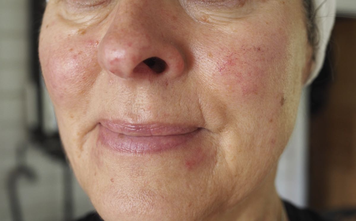 Ruusufinni – näin sain sen kuriin