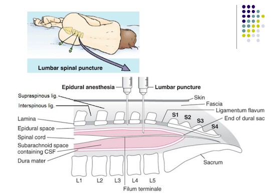 IR( interventional radiology)-8