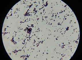 LAPORAN PRAKTIKUM MIKROBIOLOGI ALT: UJI CEMARAN MIKROBA METODE ANGKA ...