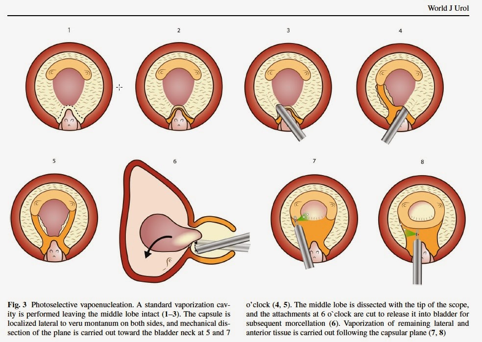 Dr. Fernando Gómez Sancha: junio 2014