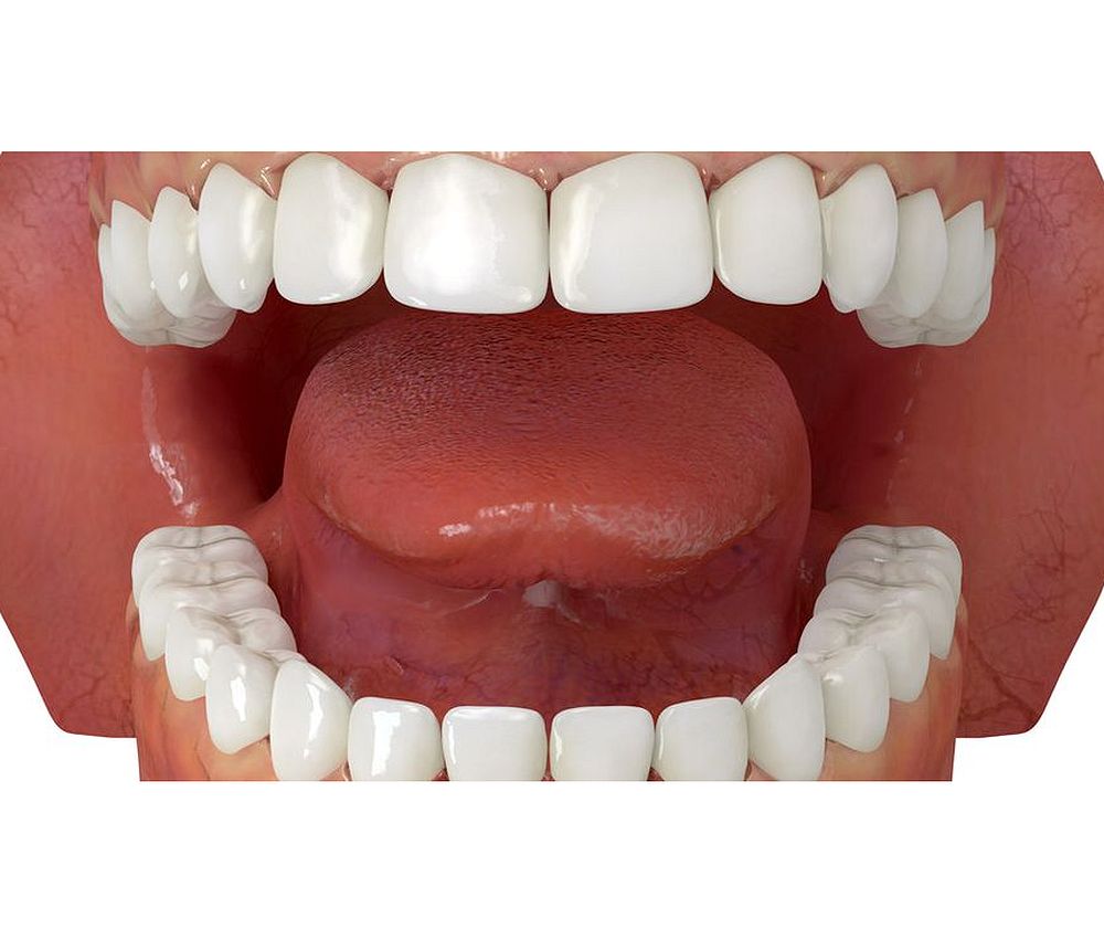 VPH: 8 manifestaciones en la boca - OdontoVida