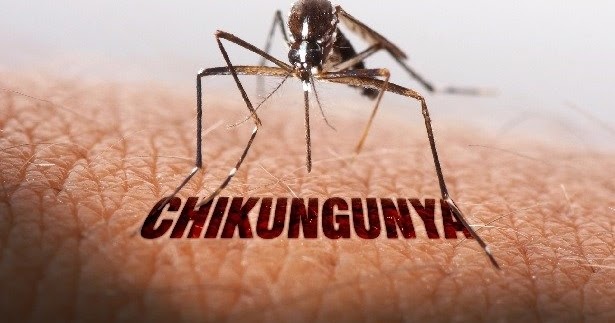 Chikungunya Viral infection, Transmission, Symptoms, Diagnosis ...