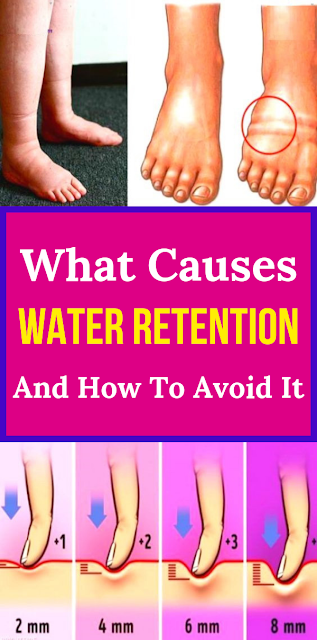 What Causes Water Retention And How To Avoid It