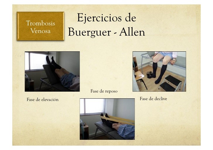 EJERCICIOS TERAPEUTICOS: Ejercicios Buerguer Allen
