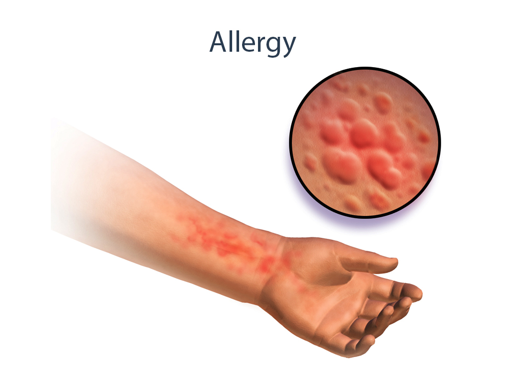 Seven Diseases that Cause Red Spots on the Skin - Good Look Tip