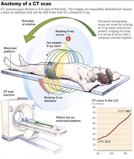 Education: CT scan-CT scan test,MRI scan and X-rays