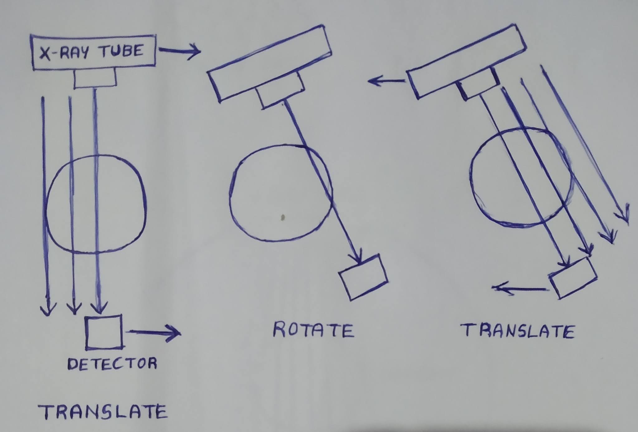 Biomedical Views: Generations of CT Scanners
