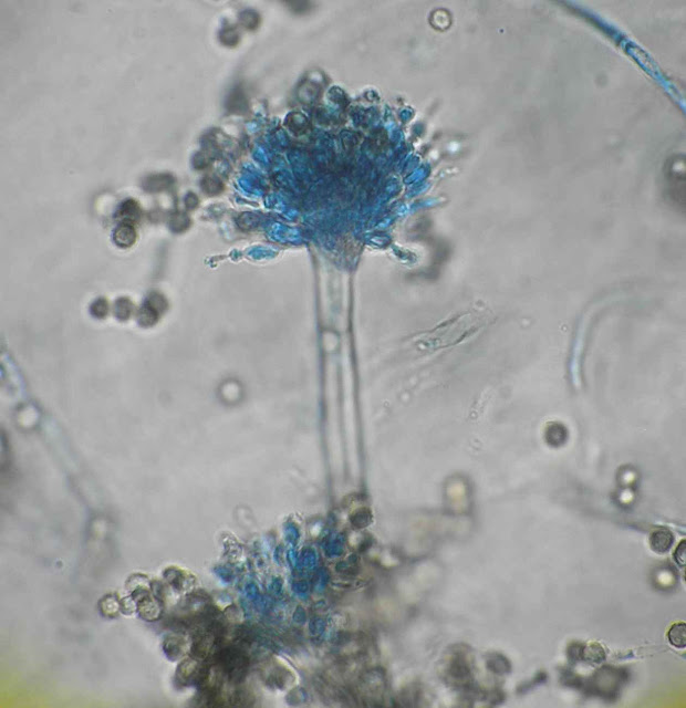 ATLAS MICOLOGIA: ASPERGILLUS USTUS COMPLEXO