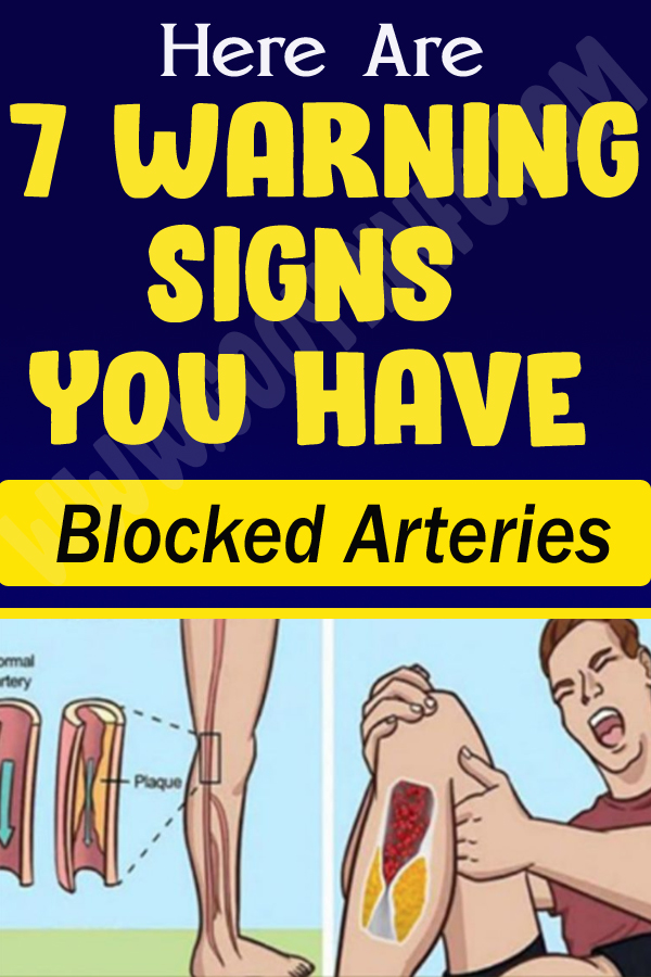 Here Are 7 Warning Signs You Have Blocked Arteries
