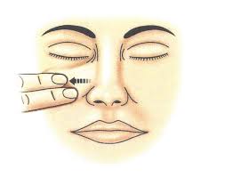 Nose Revision Surgery and Surgeons